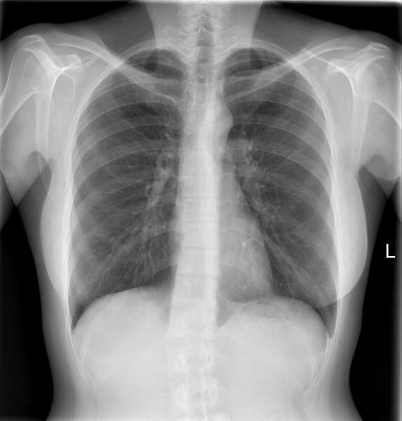 Xray Diffraction Pattern Of The Mixture Of A Green Rust
